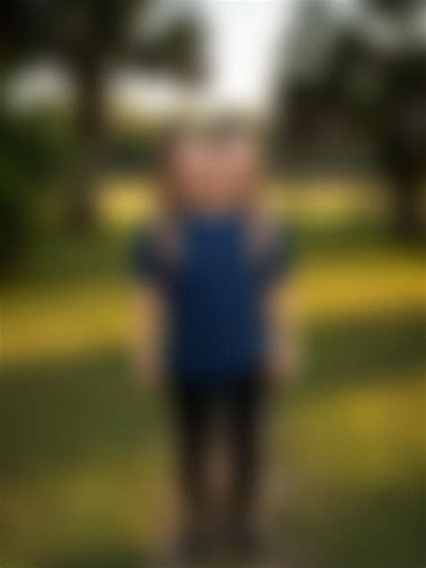 Conjoined Sisters By Devoteedelights On Deviantart