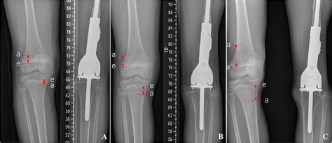 Diagram Showing The Growth Of Epiphysis Of Contralateral Healthy Download Scientific Diagram
