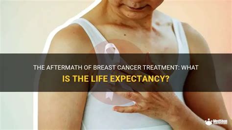 The Aftermath Of Breast Cancer Treatment What Is The Life Expectancy