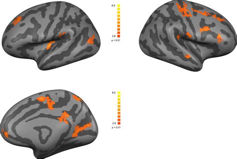 Activations Obtained When Comparing Brain Responses Of Normally Sighted Download Scientific