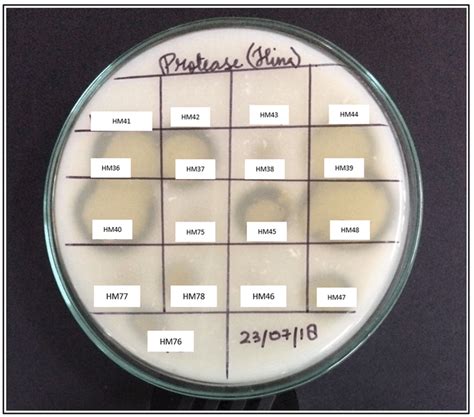 Representative Image Showing A Preliminary Screening Of Some Isolated Download Scientific