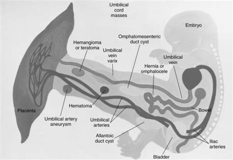Placenta And Umbilical Cord