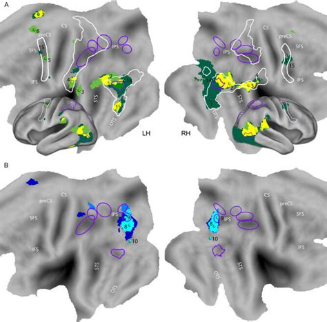 Statistical Parametric Maps Spms Showing Activated Voxels Threshold Download Scientific