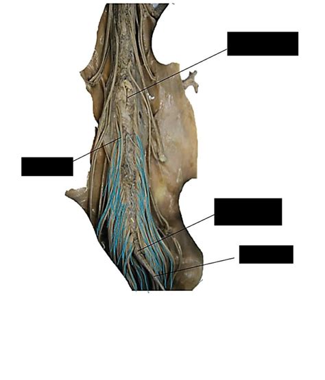 Spinal Cord Diagram Quizlet