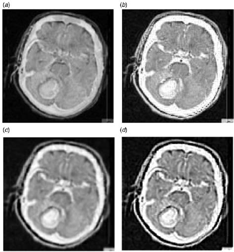 Fusion Results For Case 2 A Pca Fusion B Dwt Fusion C