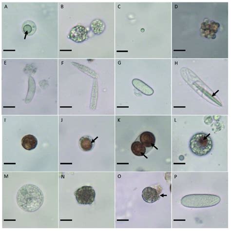 Extraction Of Multiple Cell Types Through Chemical Dissolution Before