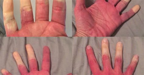 Inside My Manic Mind Sex Lies And Catecholamines Psychology Today