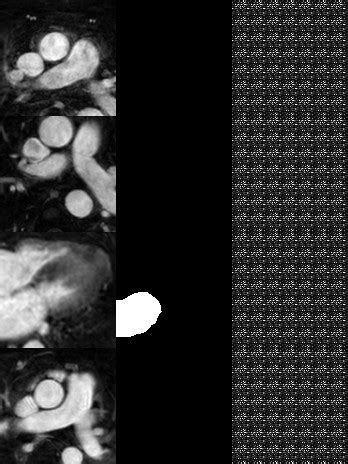 Training Problem Issue Jakeret Tf Unet GitHub