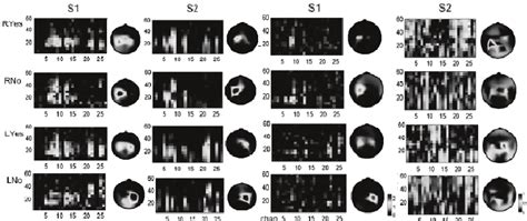 Feature Visualization Indexed By Bhattacharyya Distance For Healthy Download Scientific Diagram