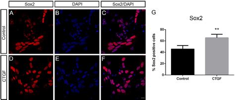 Figure 2 From Connective Tissue Growth Factor Ctgf Ccn2 Induces