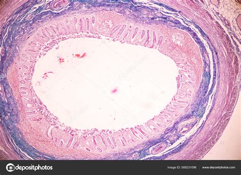 Tissue Small Intestine Duodenum Vermiform Appendix Human Microscope Lab
