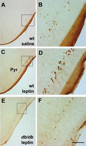Phospho Erk12 Immunohistochemistry In Sections Of Pyriform Cortex
