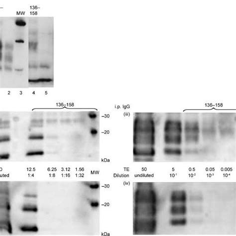 A Wb Analysis Of Prp Detected In Typical Lanes 1 2 And Atypical Download Scientific Diagram