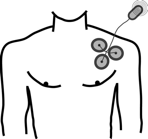 10 Figure A Shows One Of The Possible Interference Less Positions Download Scientific