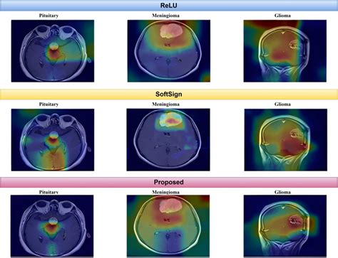 Frontiers Enhancing Brain Tumor Detection A Novel Cnn Approach With