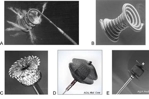 Persitierender Ductus Arteriosus Pda Meduni Wien