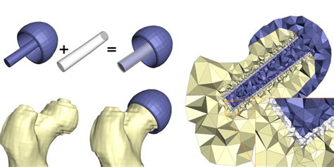 tetrahedral mesh generation for therapy planning geometryfactory