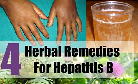 Hepatitis B Awareness Hepatitis B Is Transmitted Through Direct