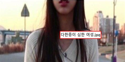 루키스트 게임 다한증 때문에 겨울에도 드러내는 여자 와 저 부위는 상상도 못 했네 → 본문