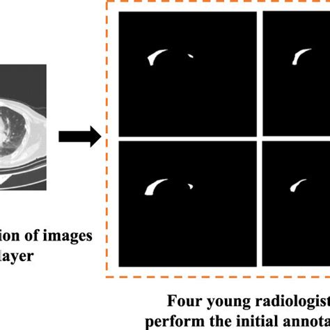Flowchart Of The Pixel Level Annotation Process For Pneumothorax Ct