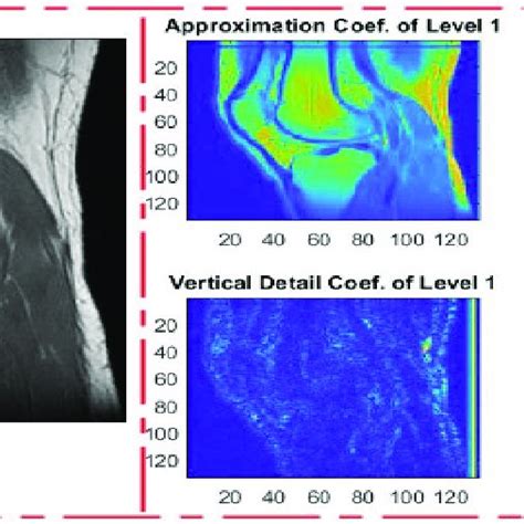 Visual Results Of Wavelet Decomposition Original Approximation Download Scientific Diagram