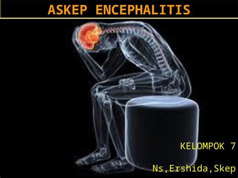 Ppt Ppt Encephalitis Dokumen Tips