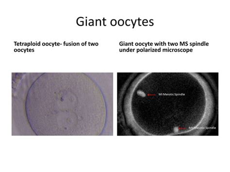 Oocyte And Embryo Grading Blastocyst Grading Pptx