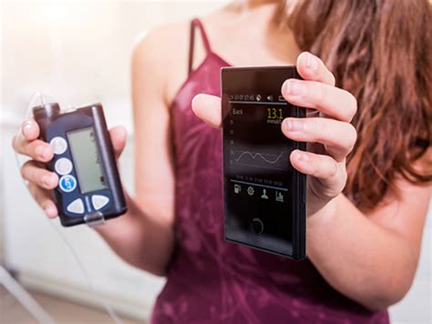 Diabetes Technology The Future Is Today Uab Expert Says Uab Reporter