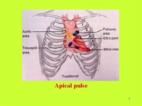 Chapter 10 Assessment Of Cardiovascular System 1 Subjective