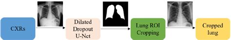 the segmentation approach showing dilated dropout u net based mask