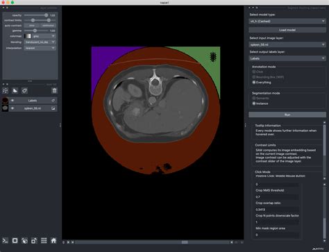 The Results Seem To Be Wrong · Issue 8 · Mic Dkfznapari Sam · Github