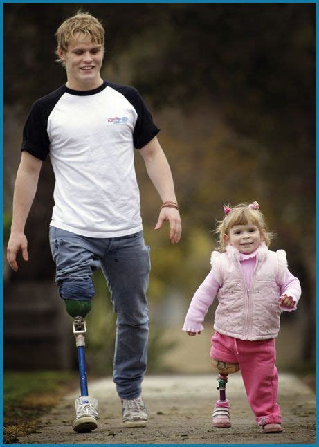 Life Without Limb Its The Astonishing Story Of The Man Born Without