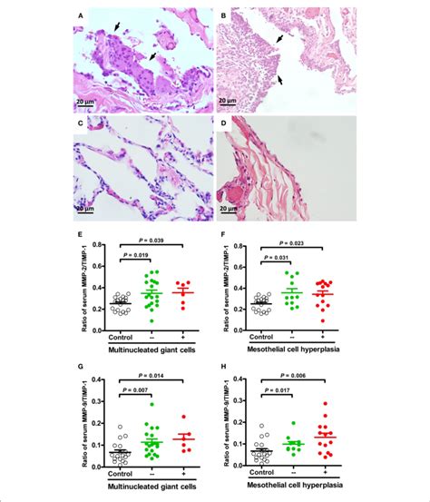 Representative Micrographs Hande × 400 Of Multinucleated Giant Cells