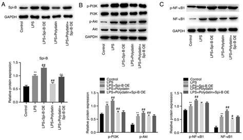 Polydatin Significantly Reduces Spi B Expression And Counteracts Download Scientific Diagram