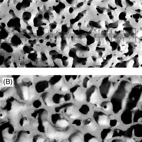 Pore Size Distribution Of Porous Ha With 60 Porosity Download