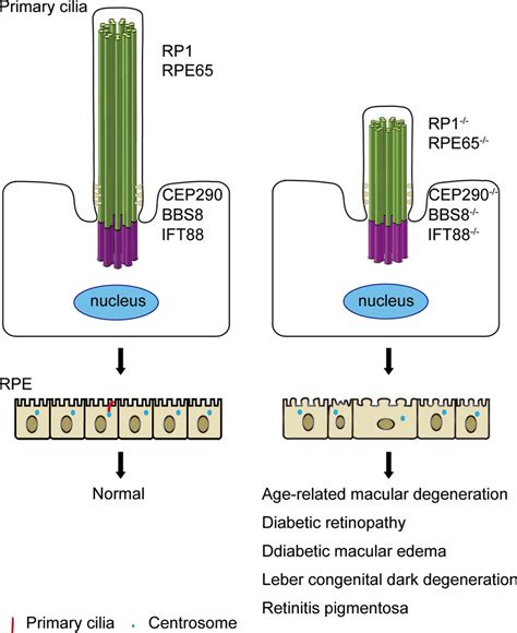 Abnormal Primary Cilia Lead To Rpe Dysfunction And Related Diseases