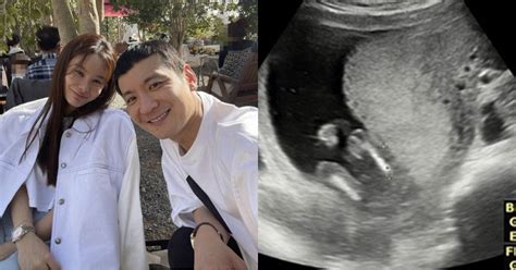 정성호 “아내 다섯째 임신…다들 손자로 오해” 서울pn