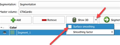 Overview 3d Slicer Segmentation Recipes