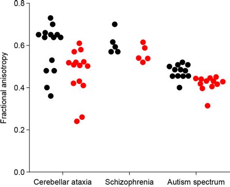 Fractional Anisotropy Values Of Superior Cerebellar Peduncle Of