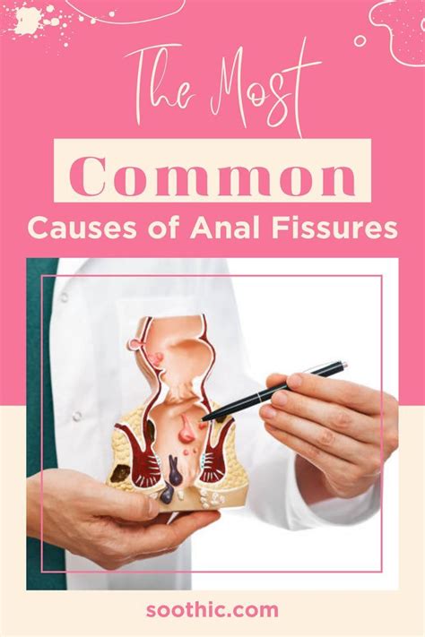 What Are The Most Common Anal Fissure Causes Artofit