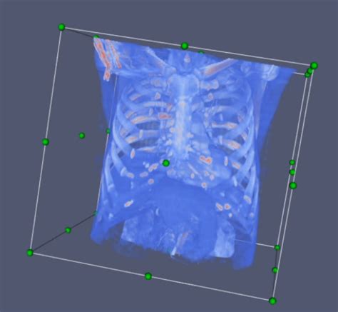 VTK Js Video Tutorials Integrating Scientific Visualizations Into OHIF