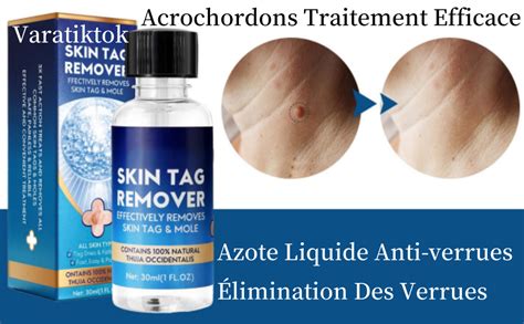 Azote Liquide Anti Verrues Acrochordons Traitement Efficace Sérums D
