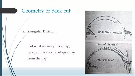 Biogeometry Of Flaps Ppt
