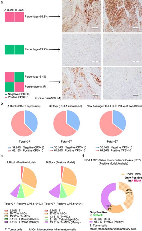Frequency Distribution Of Pd‐l1 Expression Between Different Blocks