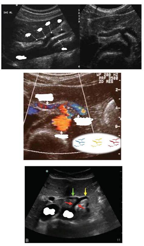 Celiac Axis Labeling Diagram Quizlet