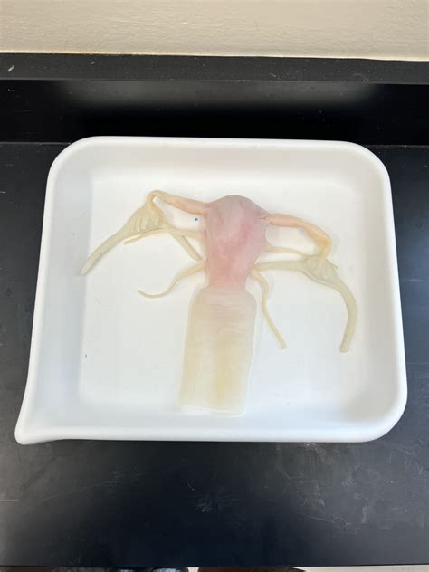 Uterus Diagram Quizlet