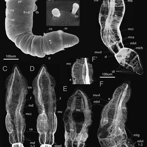 Ultrastructure Of Chaetal Muscles Of The Late Metatrochophore Of Download Scientific Diagram Ultrastructure Of Chaetal Muscles Of The Late Metatrochophore Of Download Scientific Diagram