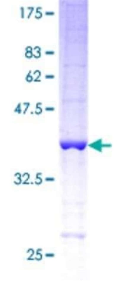 Novus Biologicals Recombinant Human Hemoglobin Epsilon Gst N Term Protein 10 μg Buy Online