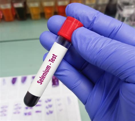 Selenium Deficiency Screening Why It Matters For Thyroid Health Mediway Medical Centre