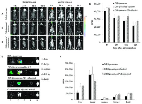 Live imaging analysis of DIR-labeled nanoparticles after intranasal ...